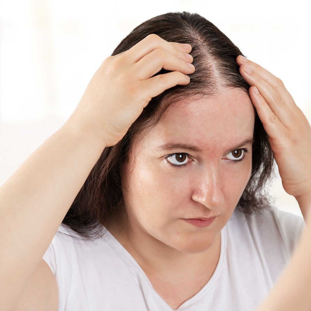 How to Regrow Your Frontal Hairline: Effective Tips and Treatments ...